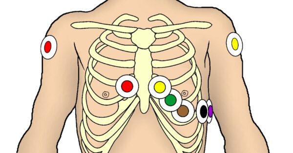 ECG Leads Placement Tips for Clear Heart Readings - Capasee.com