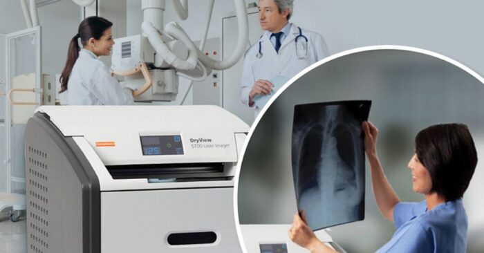 High-Quality X-Ray Illuminator for Clear Medical Imaging - Capasee.com