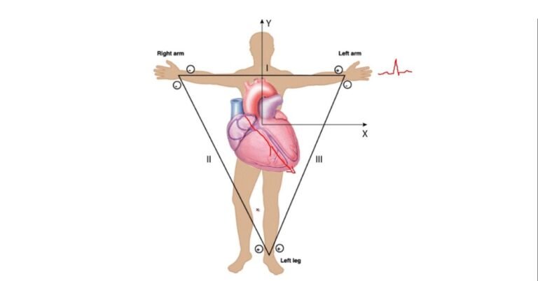 ECG Leads Placement Tips for Clear Heart Readings - Capasee.com