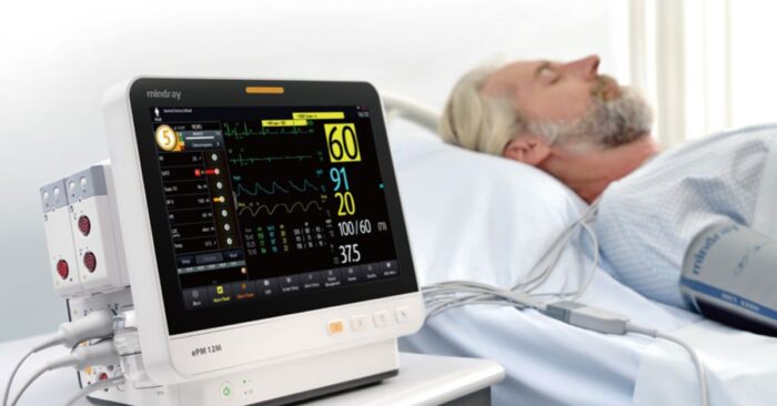 The Best Patient Monitors for Hospitals in Pakistan: A Review - Capasee.com