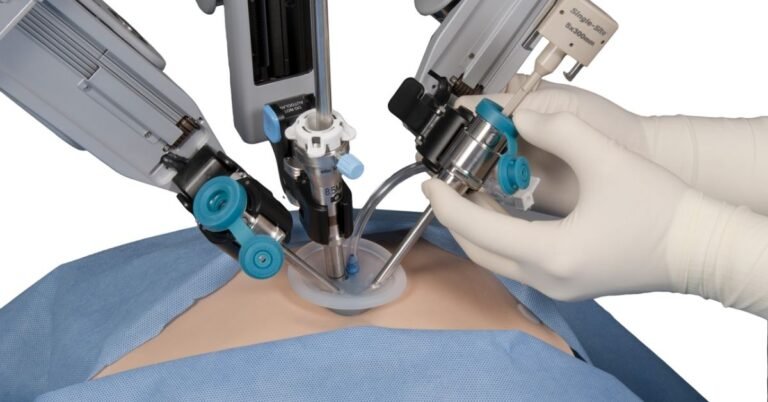 Laparotomy vs Laparoscopy: Key Surgical Differences - Capasee.com