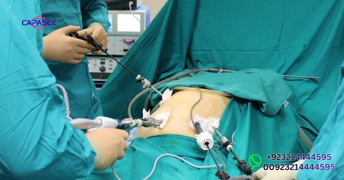 Laparoscopic Laparotomy